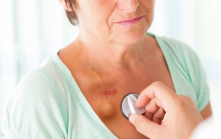 A comprehensive guide to implantable ports | Vygon (UK) Ltd