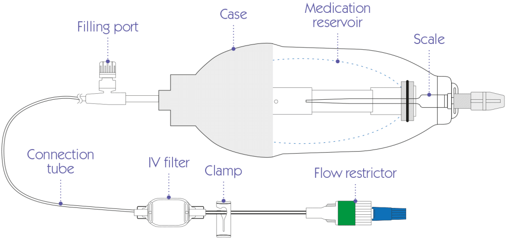 Accufuser Elastomeric Infusion Pump | Vygon (UK) Ltd